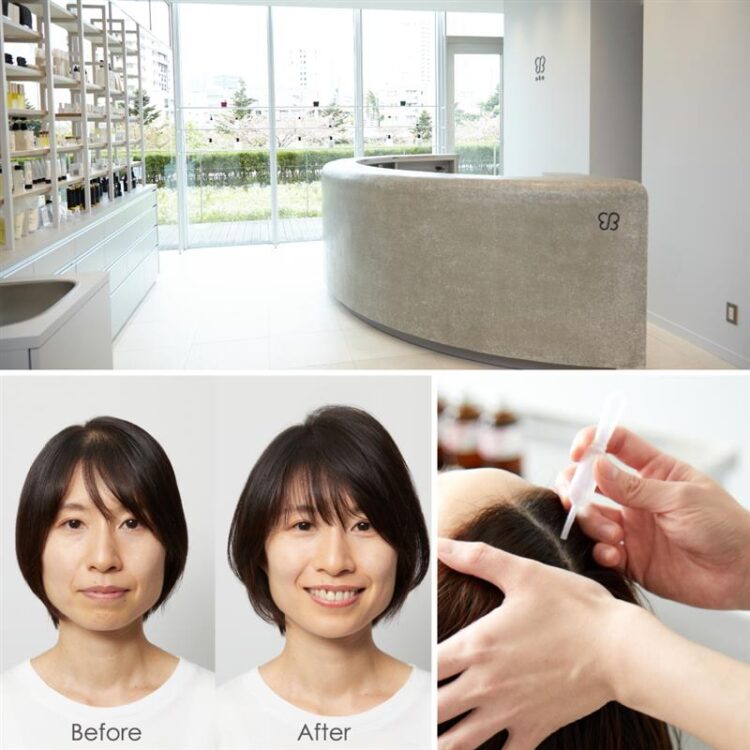 ヘアグロースで抜け毛が増えるこの季節に頭皮ケアを！ | トータルビューティーカンパニー uka
